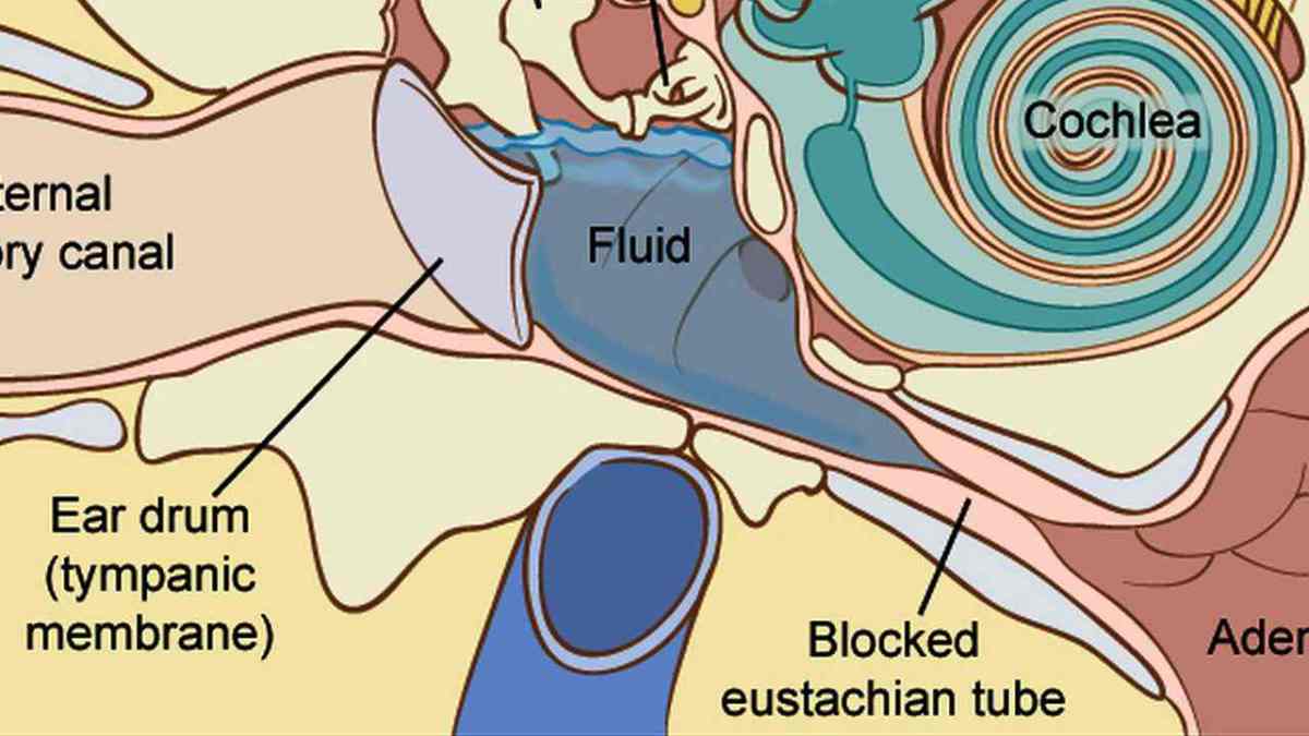 How To Treat Fluid In The Ear Howcast