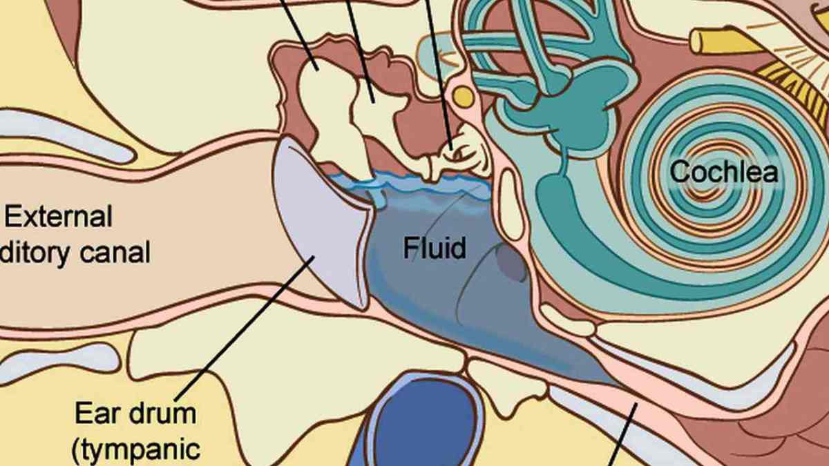 What Are Ear Tubes Howcast